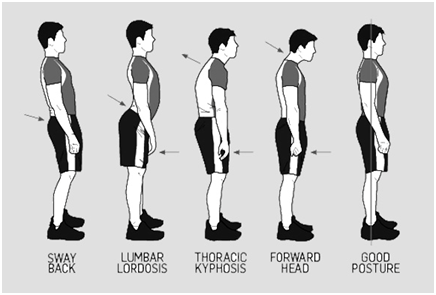 Body Posture. What’s all the fuss about? | by Physio Vibrations | Medium