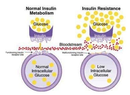 What, exactly is insulin resistance? | by Dr. Jason Fung | Healthcare in America