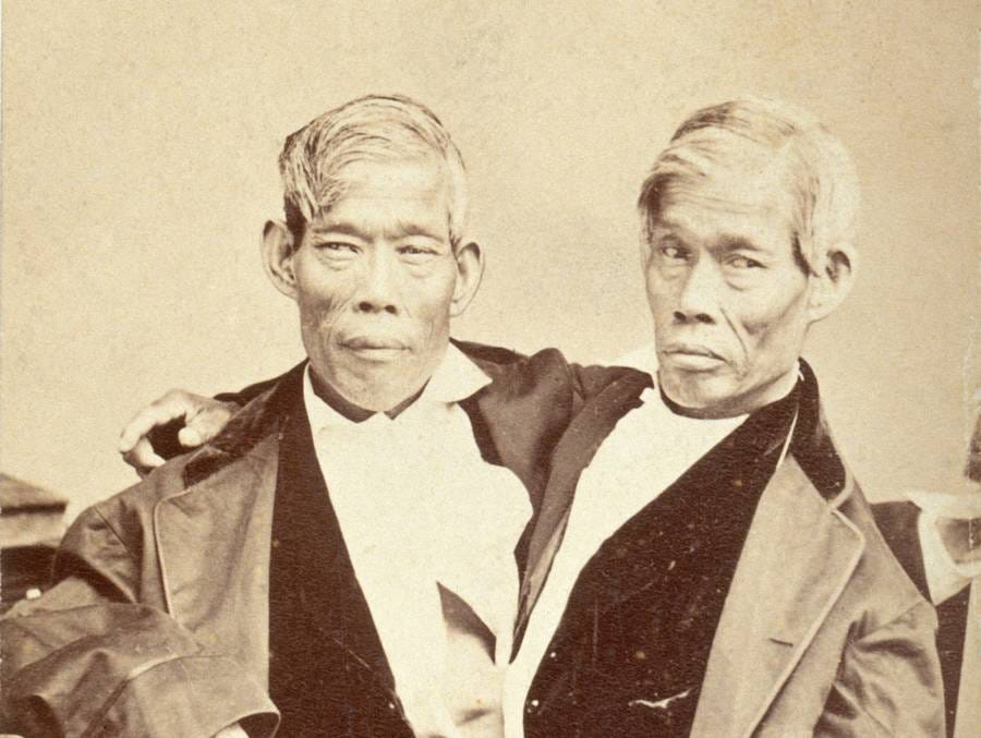 The Story of Conjoined Twins Chang & Eng | by Kassondra O'Hara ...