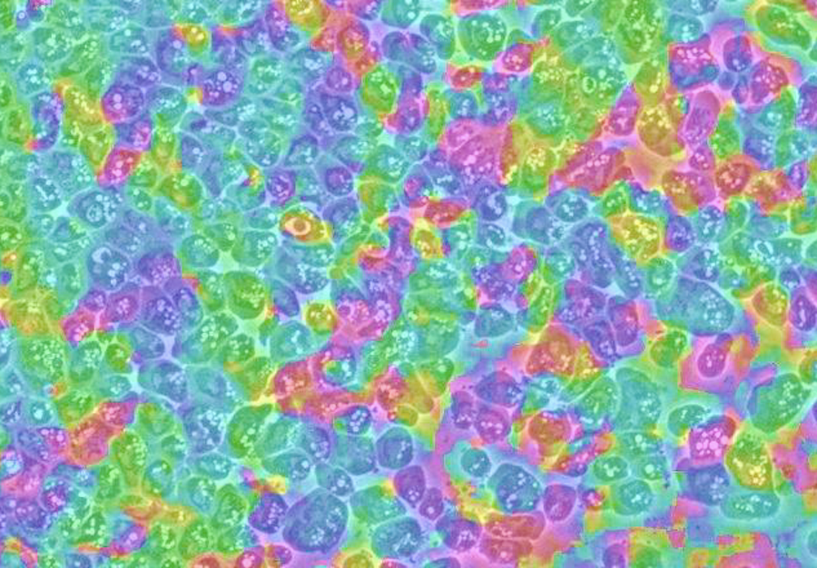 How amoeba ‘band together’. Simple interactions between individual ...
