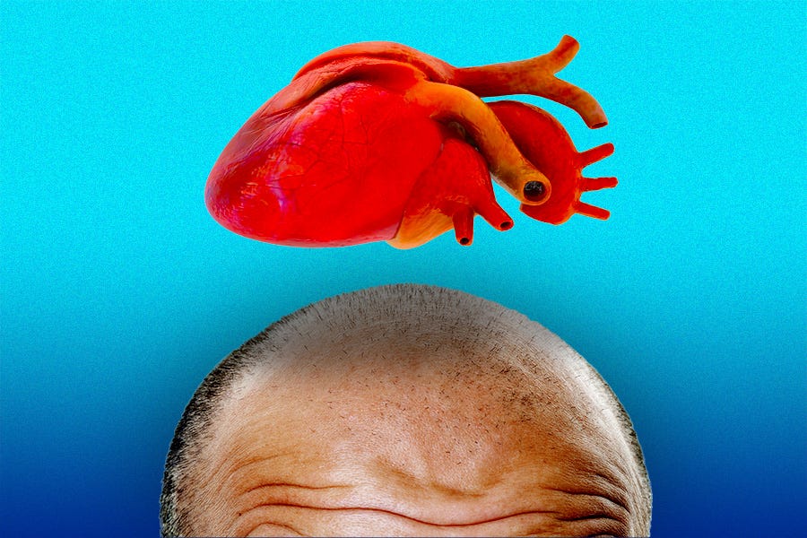 If You’re Worried About Going Bald, Don’t Be — You’ll Probably Be Dead ...