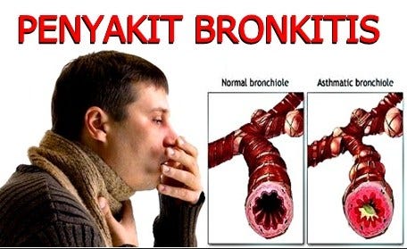 Seperti Apa Gejala Pada Penyakit Bronkitis | by Agen Pengobatan Herbal ...