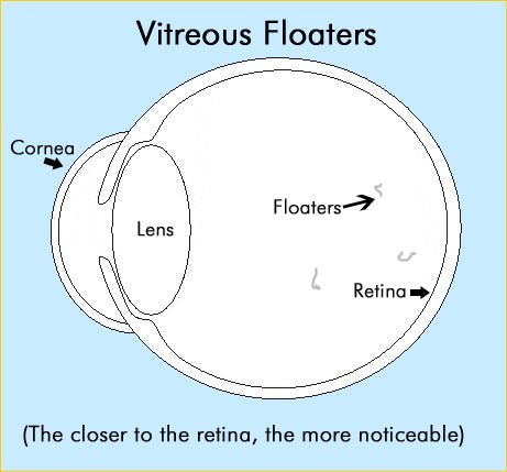Shooting Vision And Aging: Expert Advice That You Need To Know (Part 2 ...