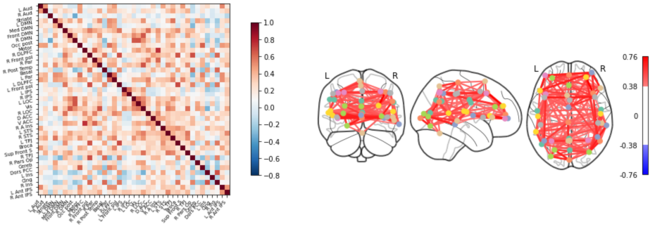 GNNs in neuroscience: graph convolutional networks for fMRI analysis | by Sidney Hough ...