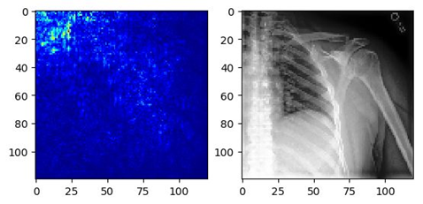 Abnormality Detection in Musculoskeletal Radiographs | by Great ...