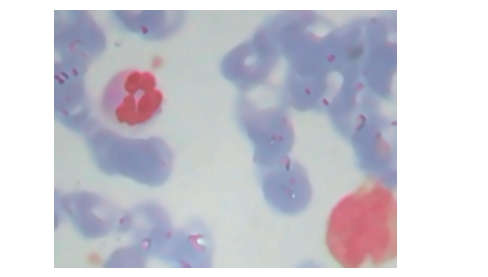 OpenCV: Count of Objects in Blood Image with Python | by Amit Chauhan | The Pythoneers | Medium