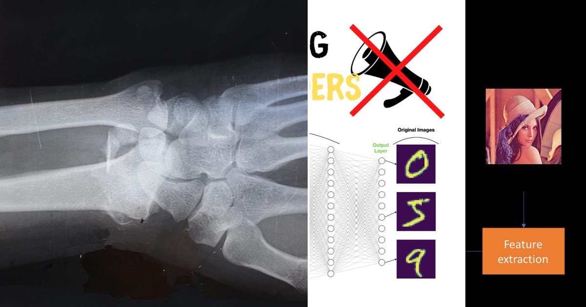 List: Image processing | Curated by Nsrtheking | Medium