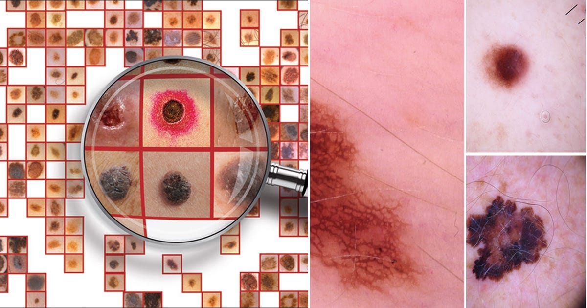 List: Skin cancer research | Curated by Kuniko Paxton | Medium