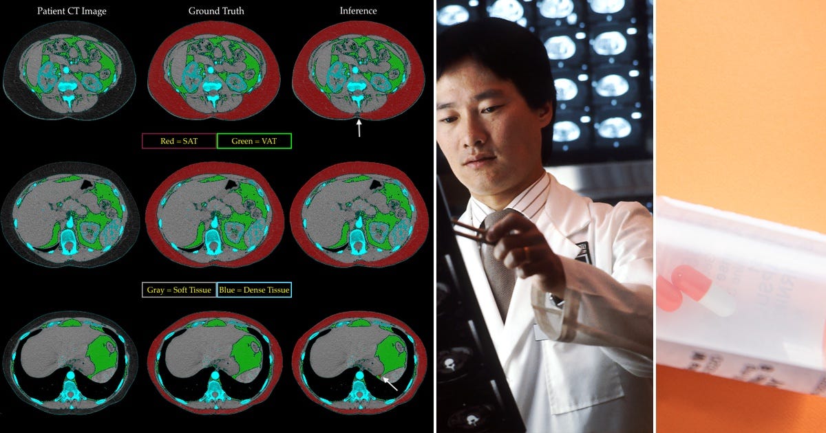 List: Segmentation | Curated by Mokhtar Z. Alaya | Medium