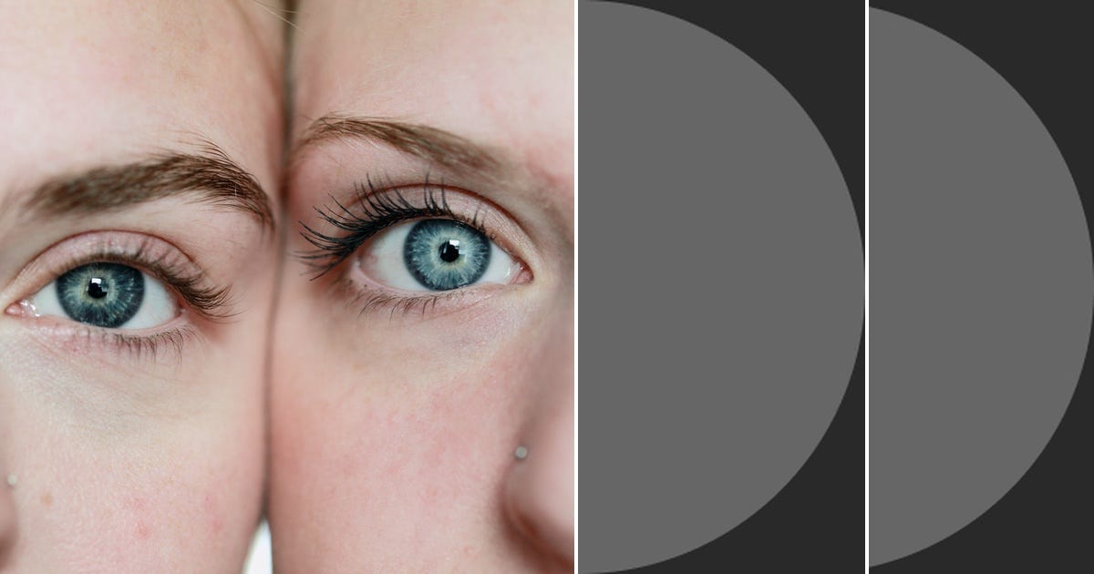 List: String similarity metric | Curated by Jin YAO | Medium