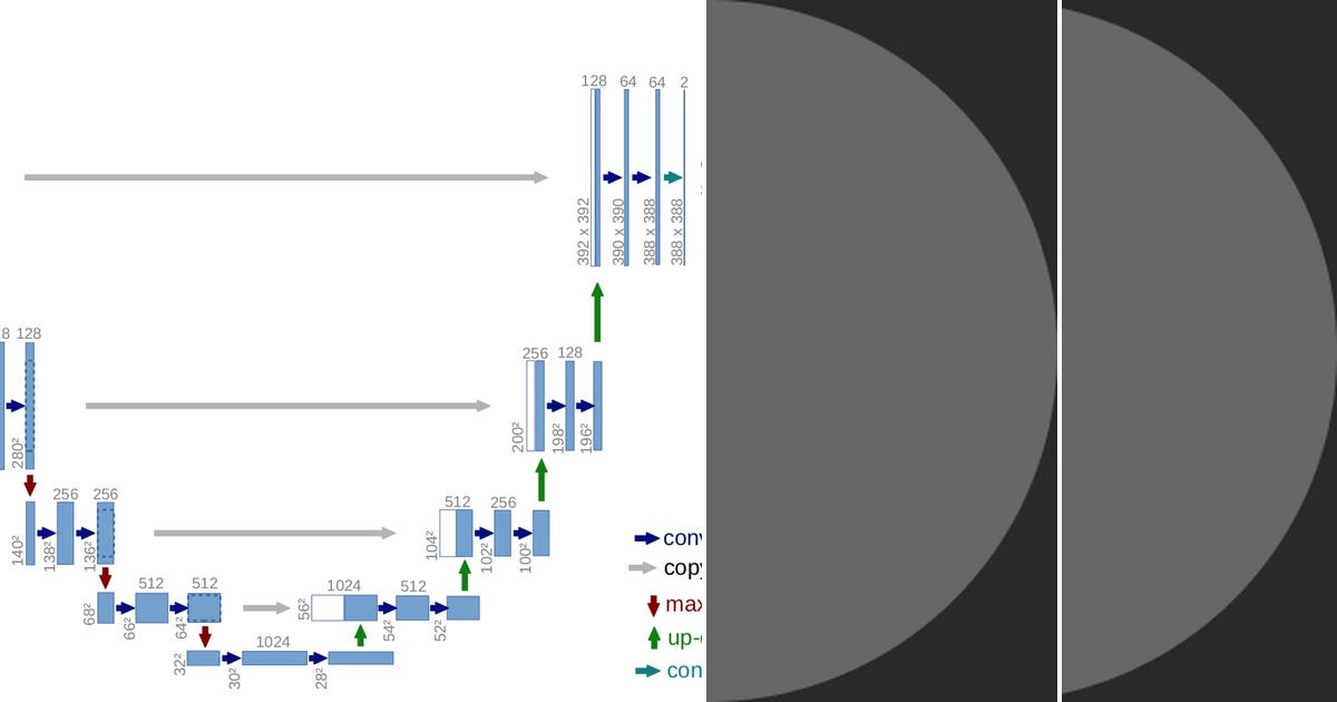 List: Computer Vision | Curated by Ding Ma | Medium