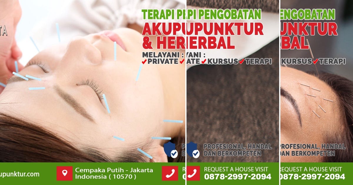 List: Akupunktur Panggilan | Curated by 0878-2997-2094 Terapi ...