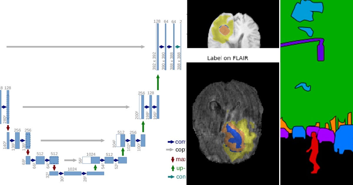 List: Segmentation | Curated by Geomolgeorge | Medium