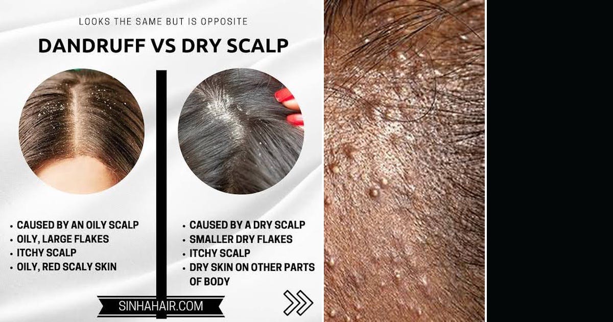 List: Scalp | Curated by Hair diary, | Medium