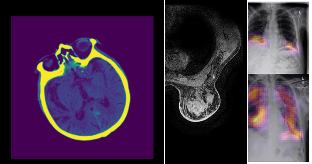 List: About DICOM | Curated by Hyeon Yu | Medium