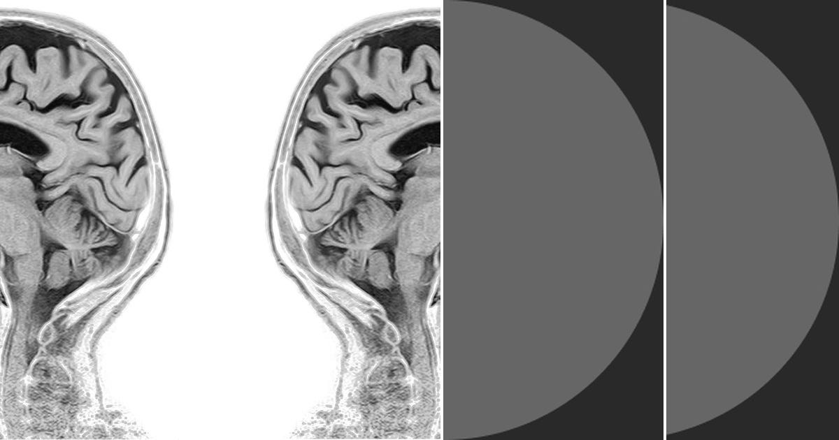 List: FMRI | Curated by Captain AE | Medium