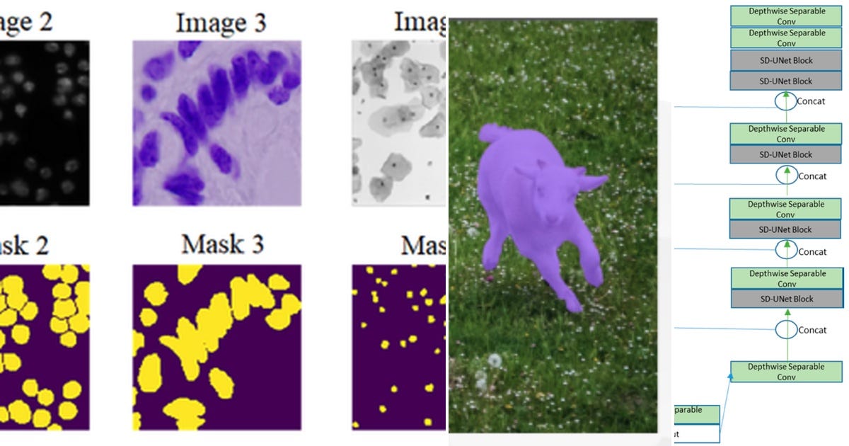 List: UNet | Curated by Abhishek Barandooru Janavejirao | Medium