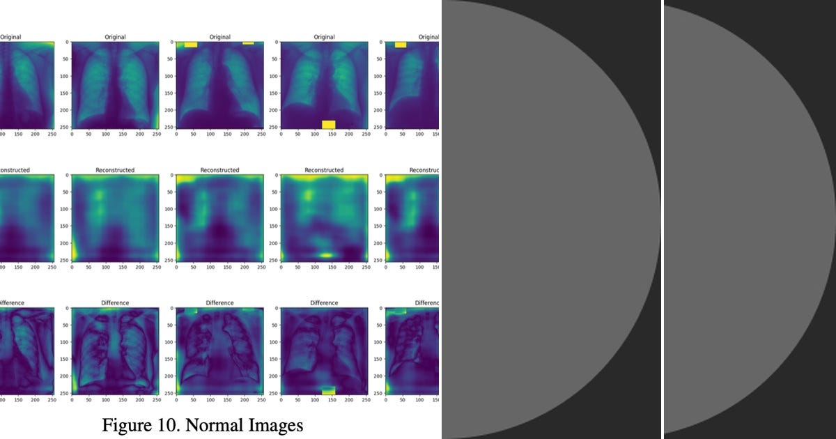 List: Anomaly Detection | Curated by Favoritgreen | Medium