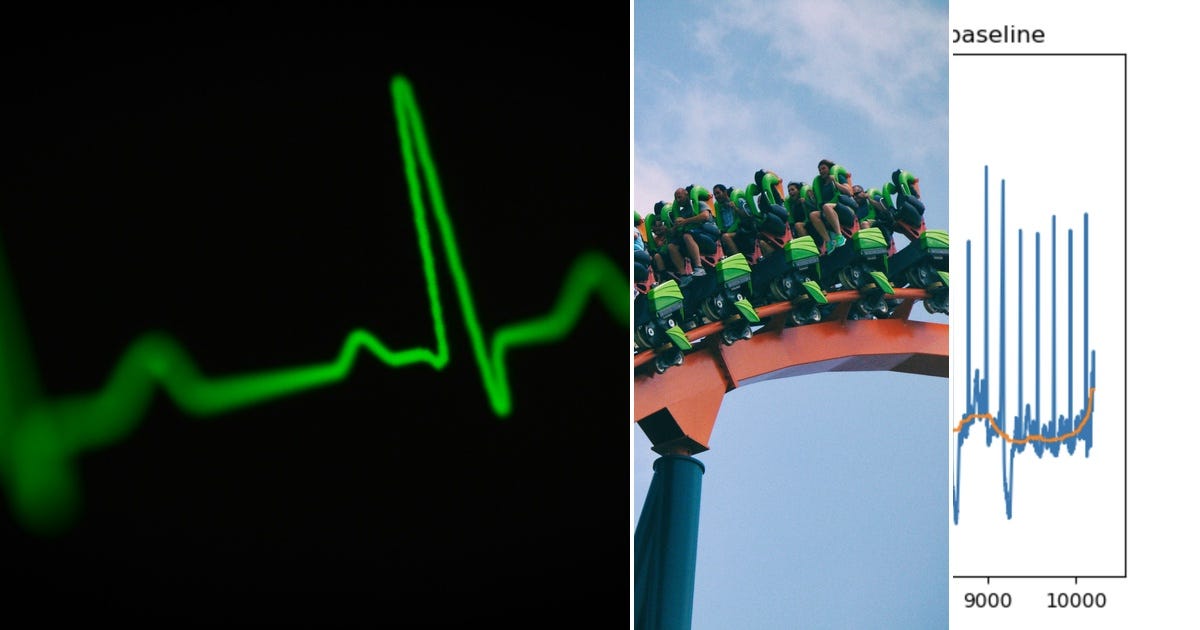 List: Heart and Electrocardiogram Analysis in Python | Curated by Proto ...