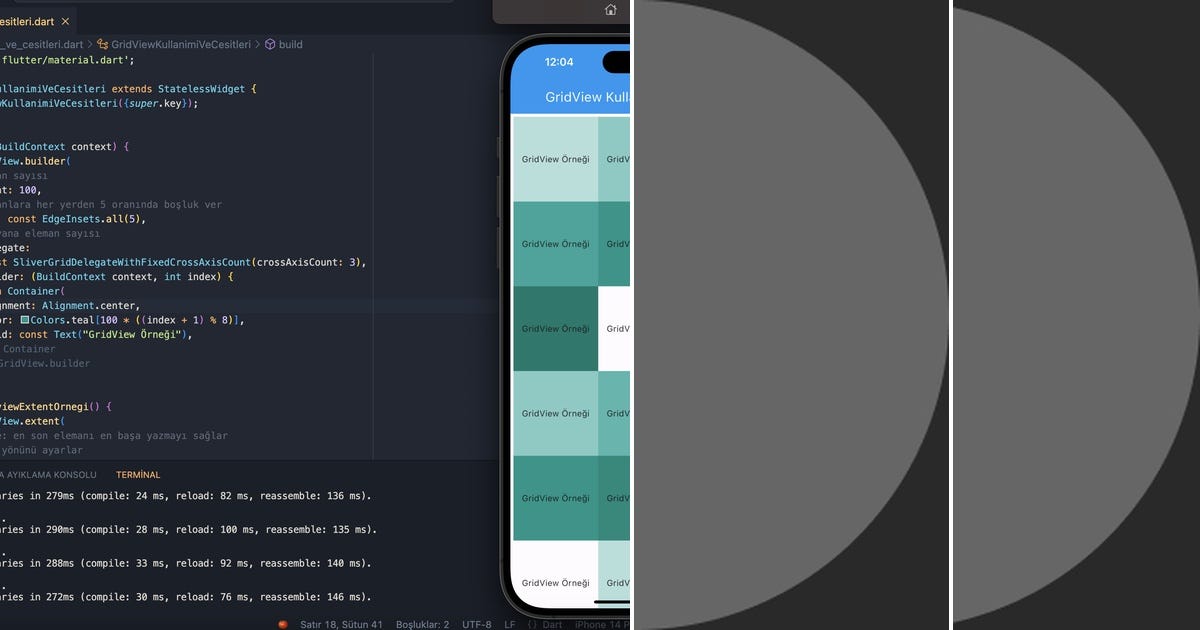 List: gridview case | Curated by turanulupinar | Medium