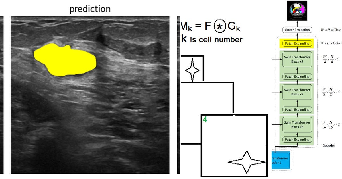List: Segmentation | Curated by Gwenn LR | Medium
