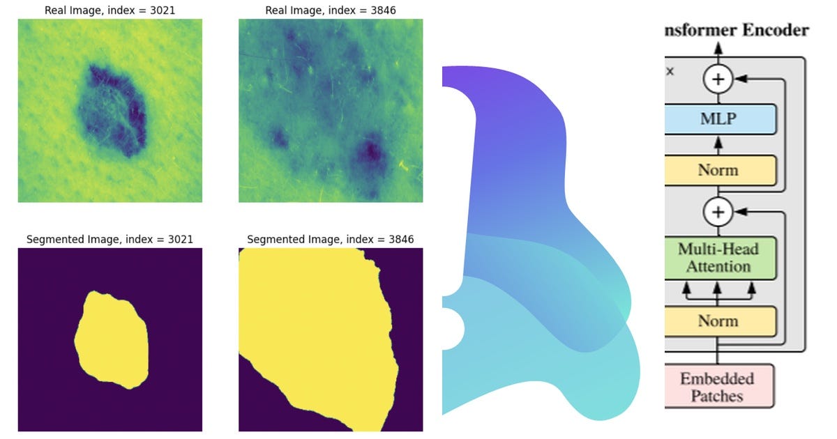 List: Vision Transformer | Curated by Walid Tajuri | Medium