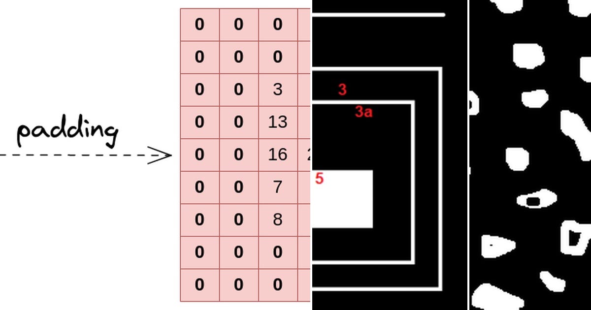 List: image Preprocessing | Curated by K | Medium