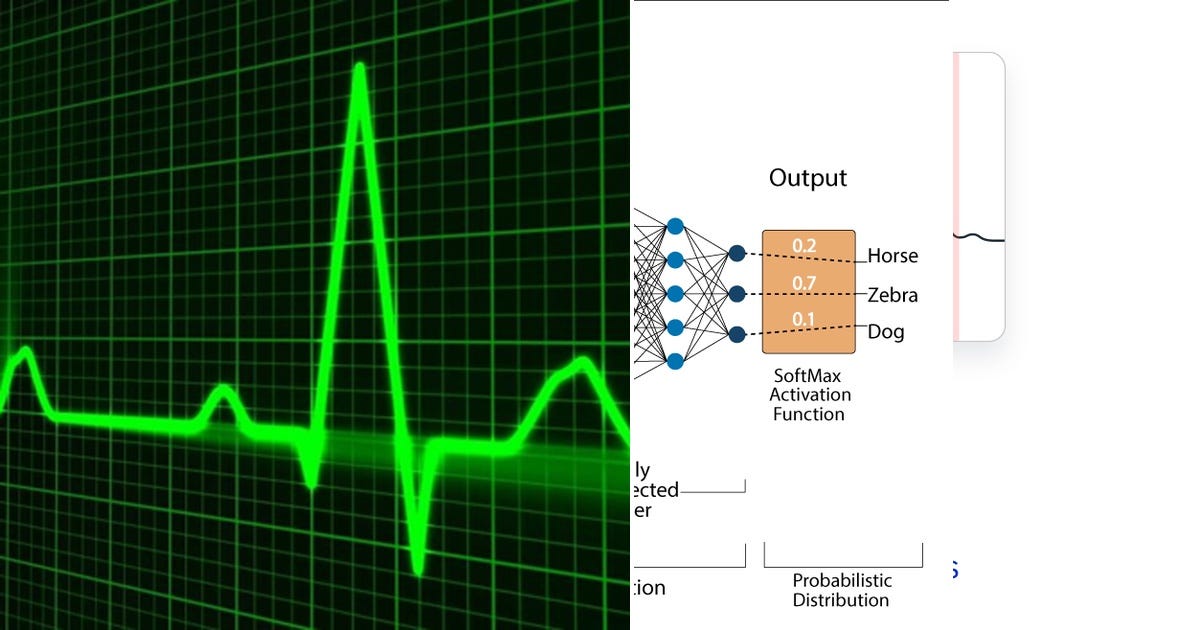 List: ECG | Curated by Steve samson | Medium
