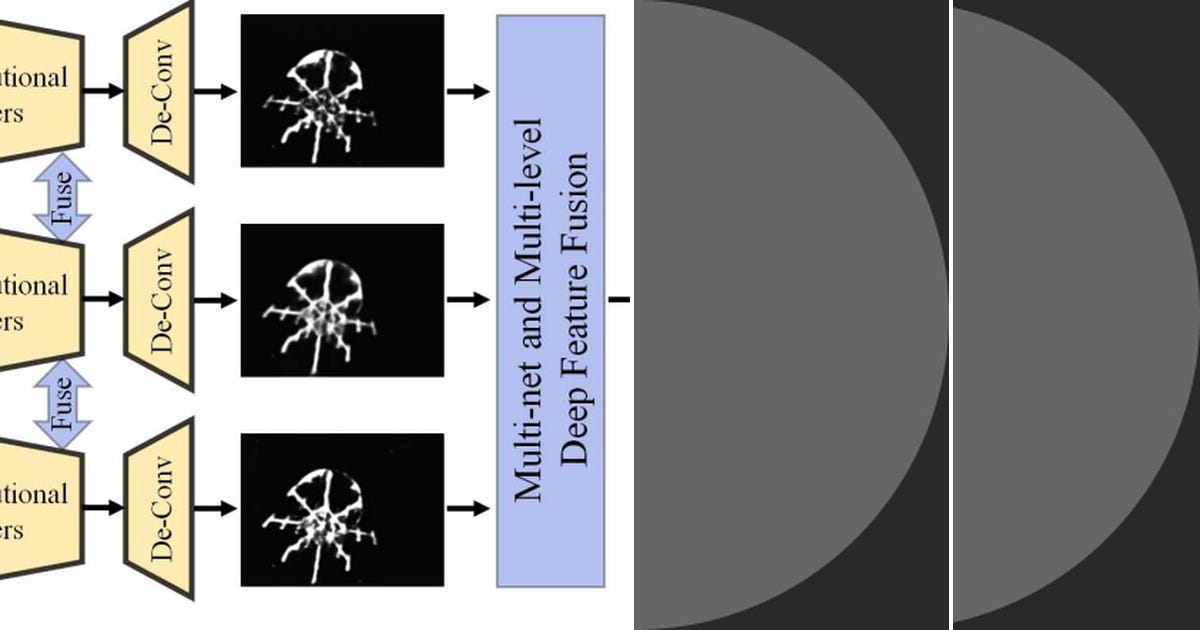 List Rgb D Object Detection Curated By 尹茂良 Medium
