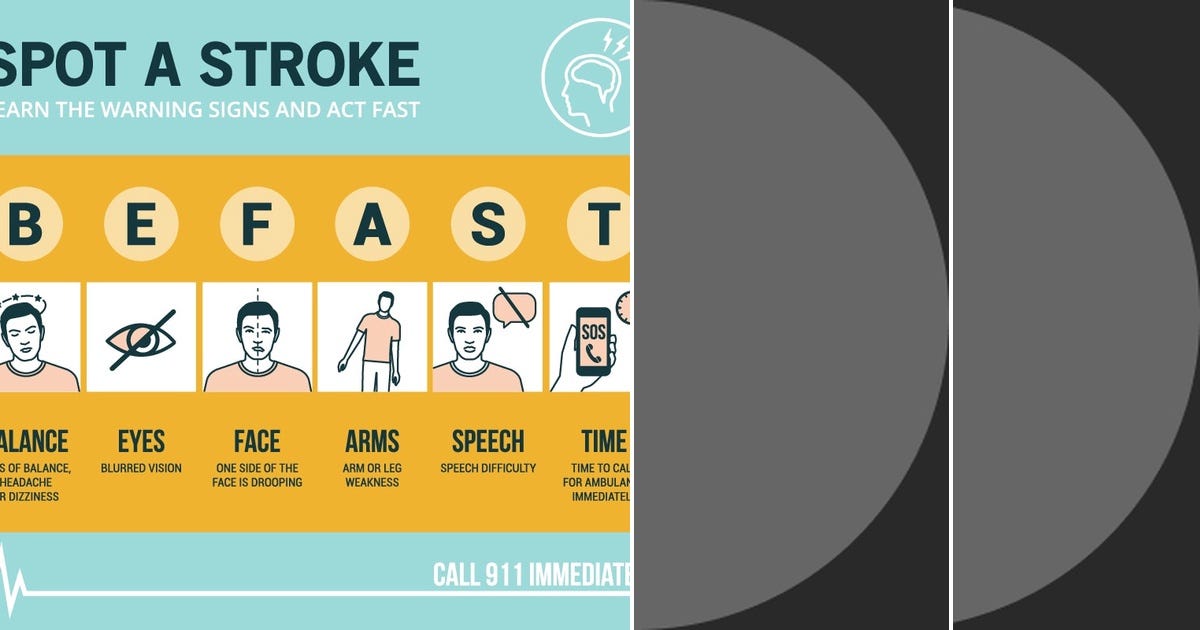 List: Stroke info | Curated by Lu Skerdoo | Medium