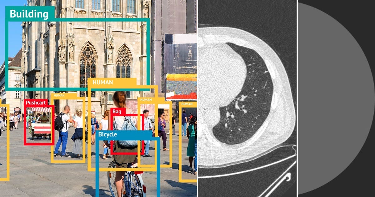 List: medical image detection | Curated by jeff brrom | Medium