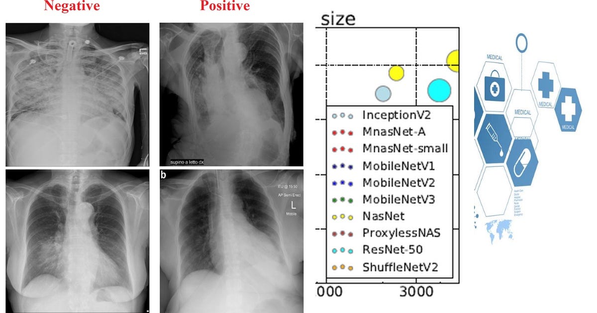 List: CNN image processing | Curated by Nine One | Medium