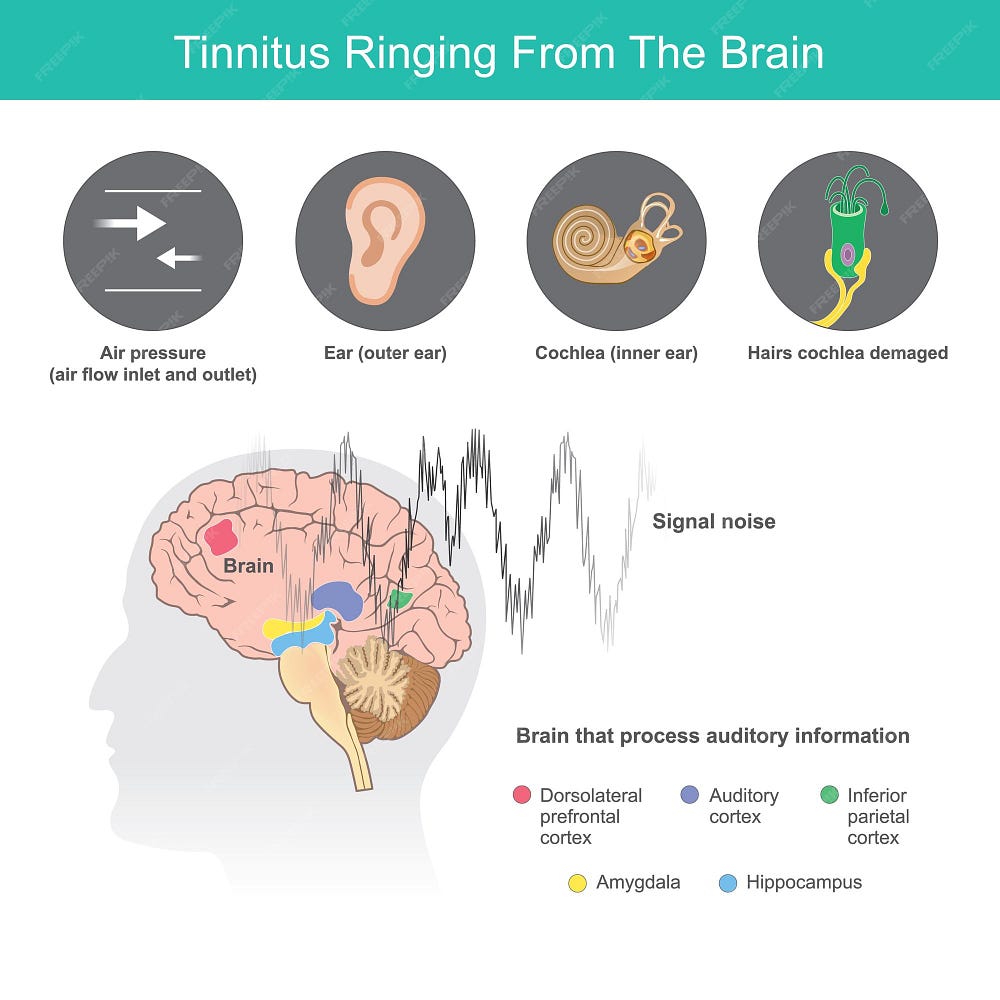 Tinnitus Causes: Unmasking the Culprits Behind the Ringing in Your Ears ...