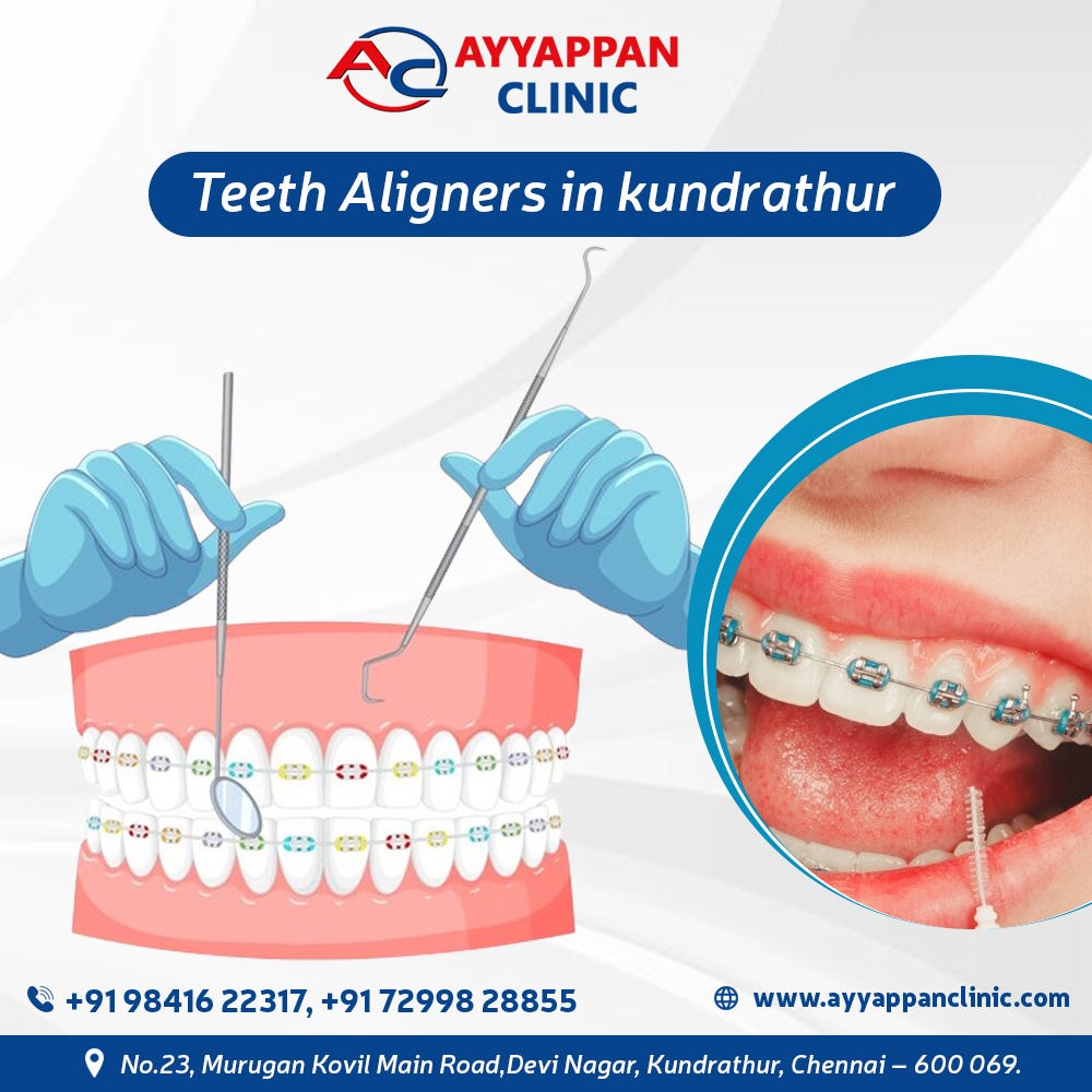 Top 5 Benefits of Choosing Teeth Aligners in Kundrathur | by Ayyappan ...