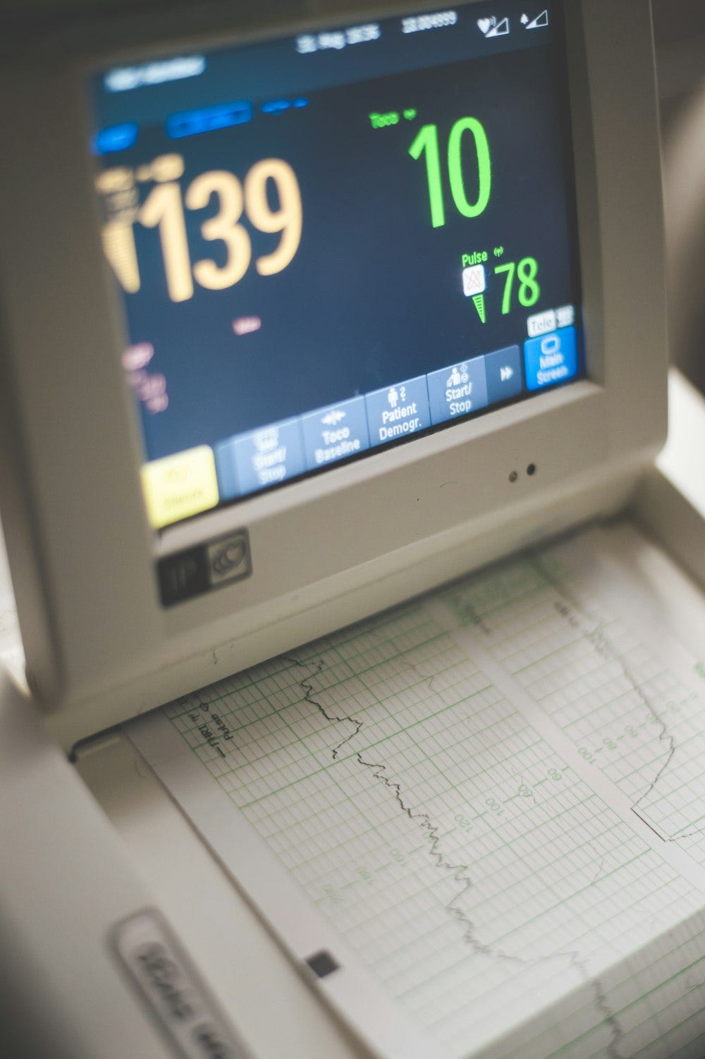 Visualizing Ecg Data A Guide To Building An Interactive Dashboard With Dash And Plotly By