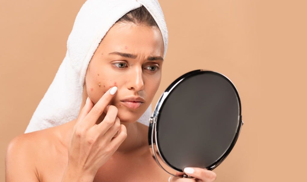 Acne treatment with Advanced Dermatology Procedures | by The Glo ...