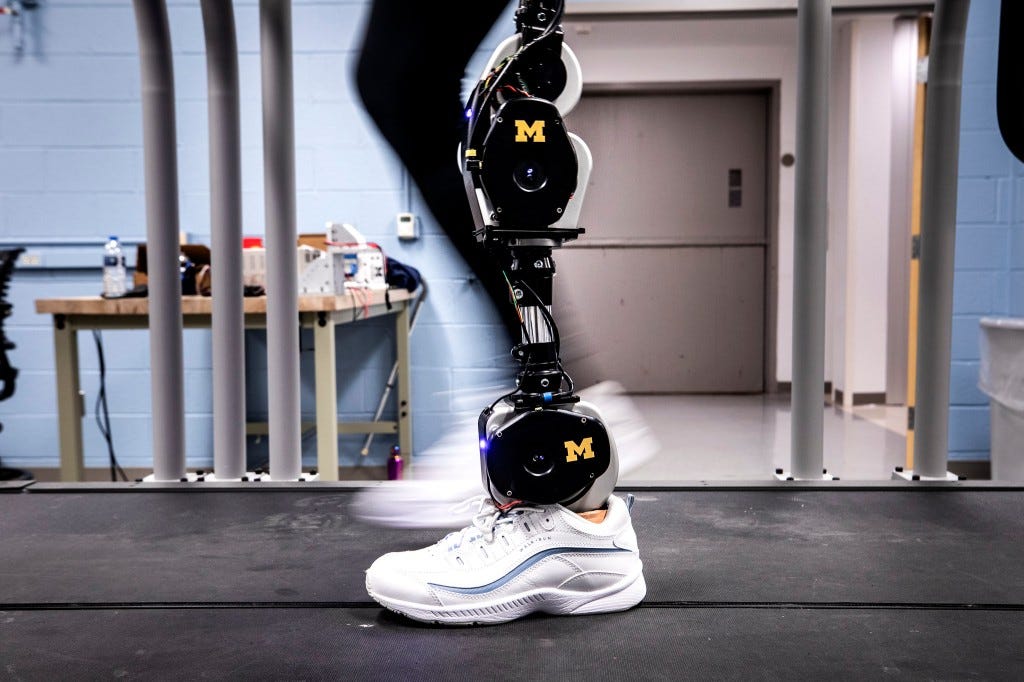 Bionic Leg Revolutionizes Prosthetics: Amputees Experience Freedom and ...