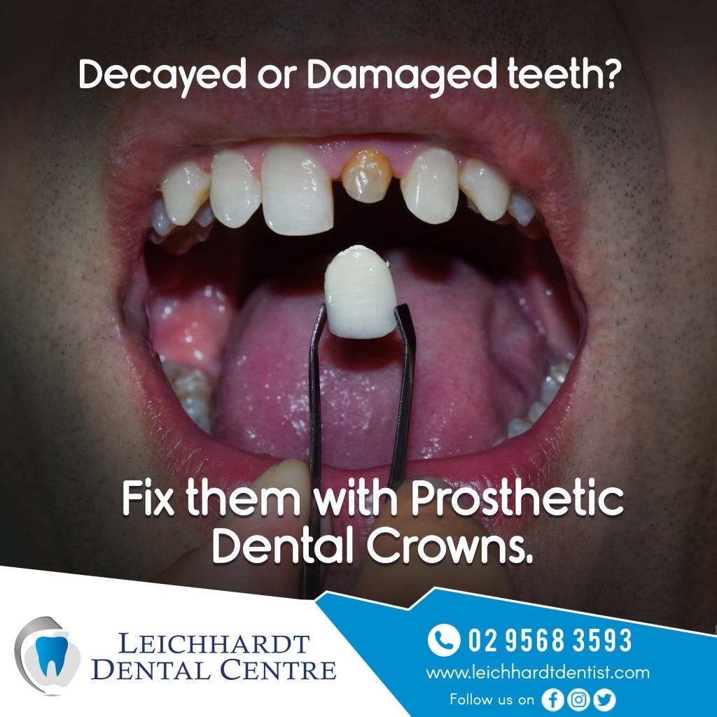 Decayed or Damaged teeth? Fix them with Prosthetic Dental Crowns | by ...