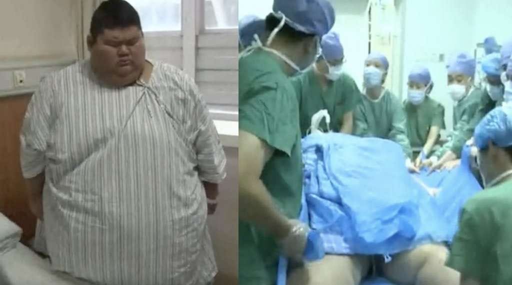 ‘China’s fattest man’ undergoes weight-loss surgery, hopes to become a ...