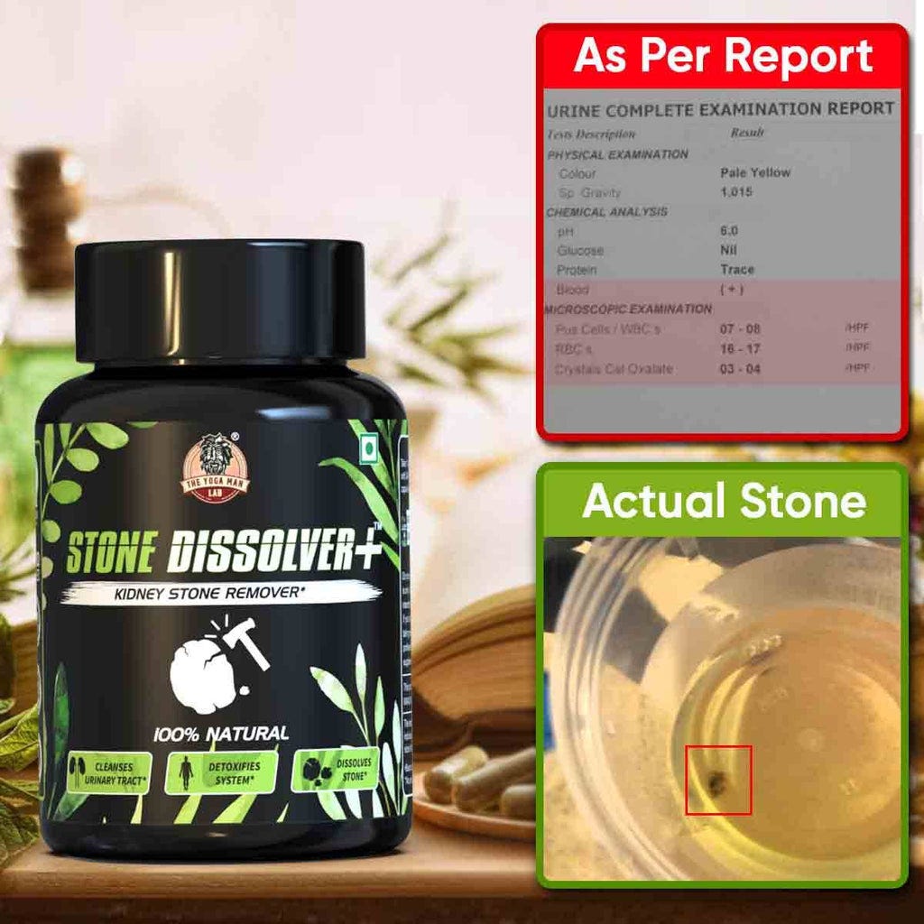 STONE DISSOLVER+ — Stone Remover Ayurvedic Supplement | 100% Natural ...