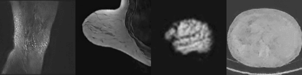 Diffusion Models in Medical Imaging: Generating Synthetic Data | by ... Diffusion Models in Medical Imaging: Generating Synthetic Data | by ...
