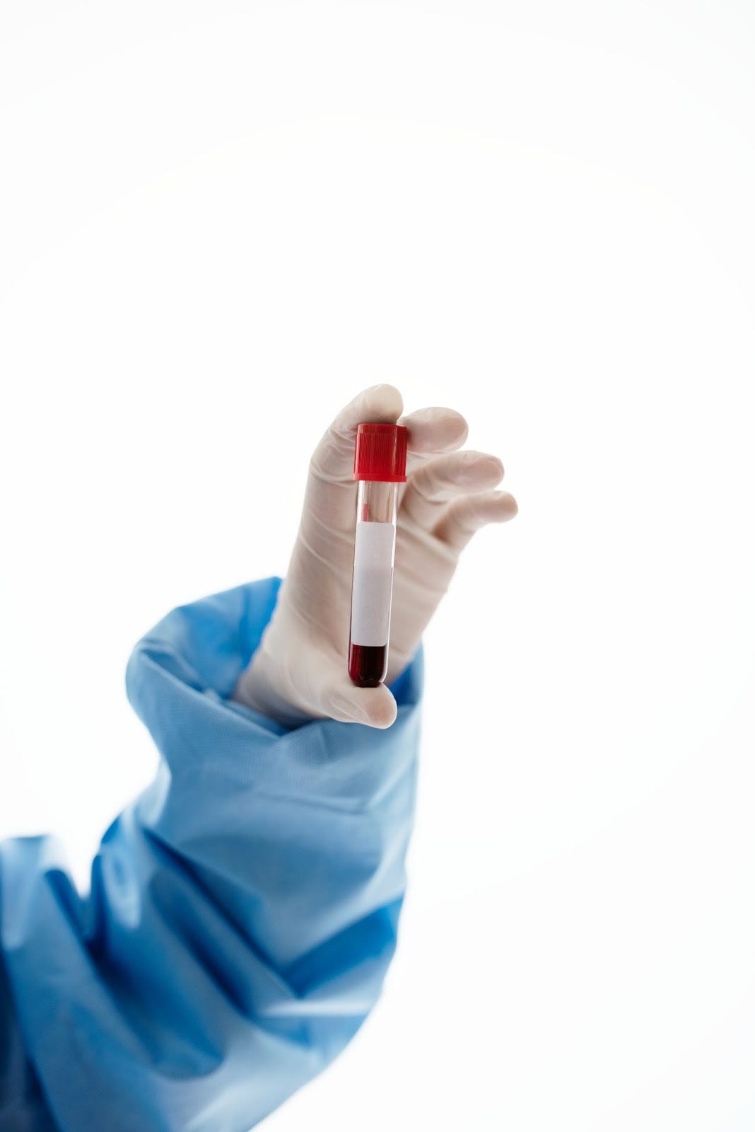 Top-Rated Blood Work in Houston Find the Best for Your Health By Filos ...