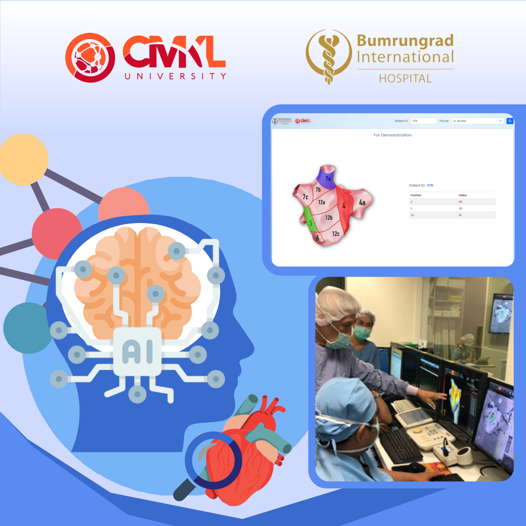 Hacking the Heart: How AI is Taking on Atrial Fibrillation — One Beat at a Time | by Nutsupa ...