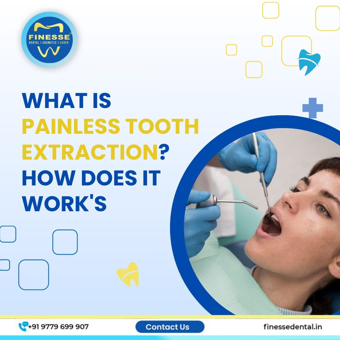 What is Painless Tooth Extraction? How does it work’s | by Finesse ...
