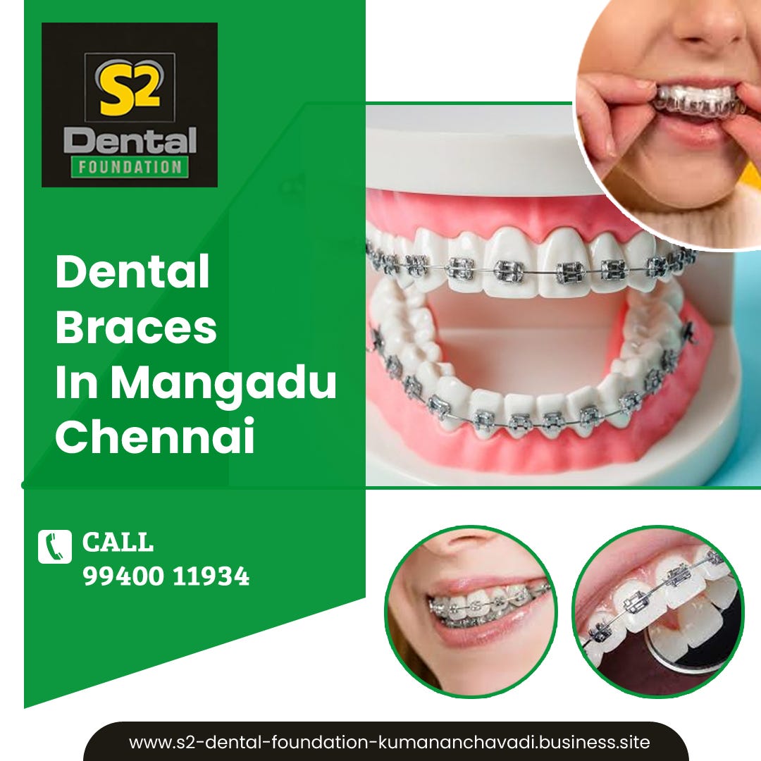Pain-Free Smile: Affordable Dental Braces in Mangadu at S2 Dental ...