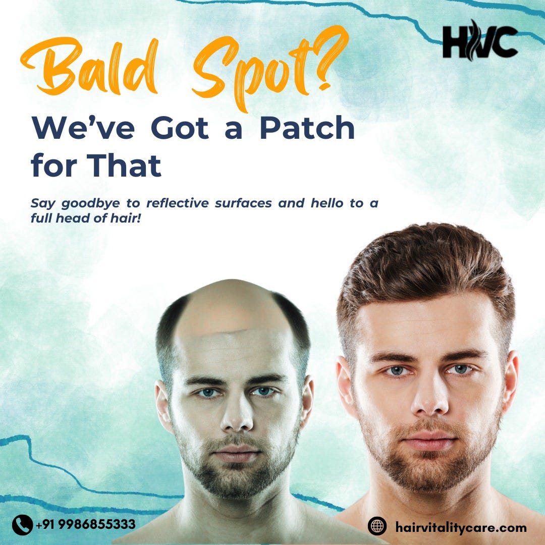 The Secret to Perfect Hair: Try Our Hair Patching Today! | by ...