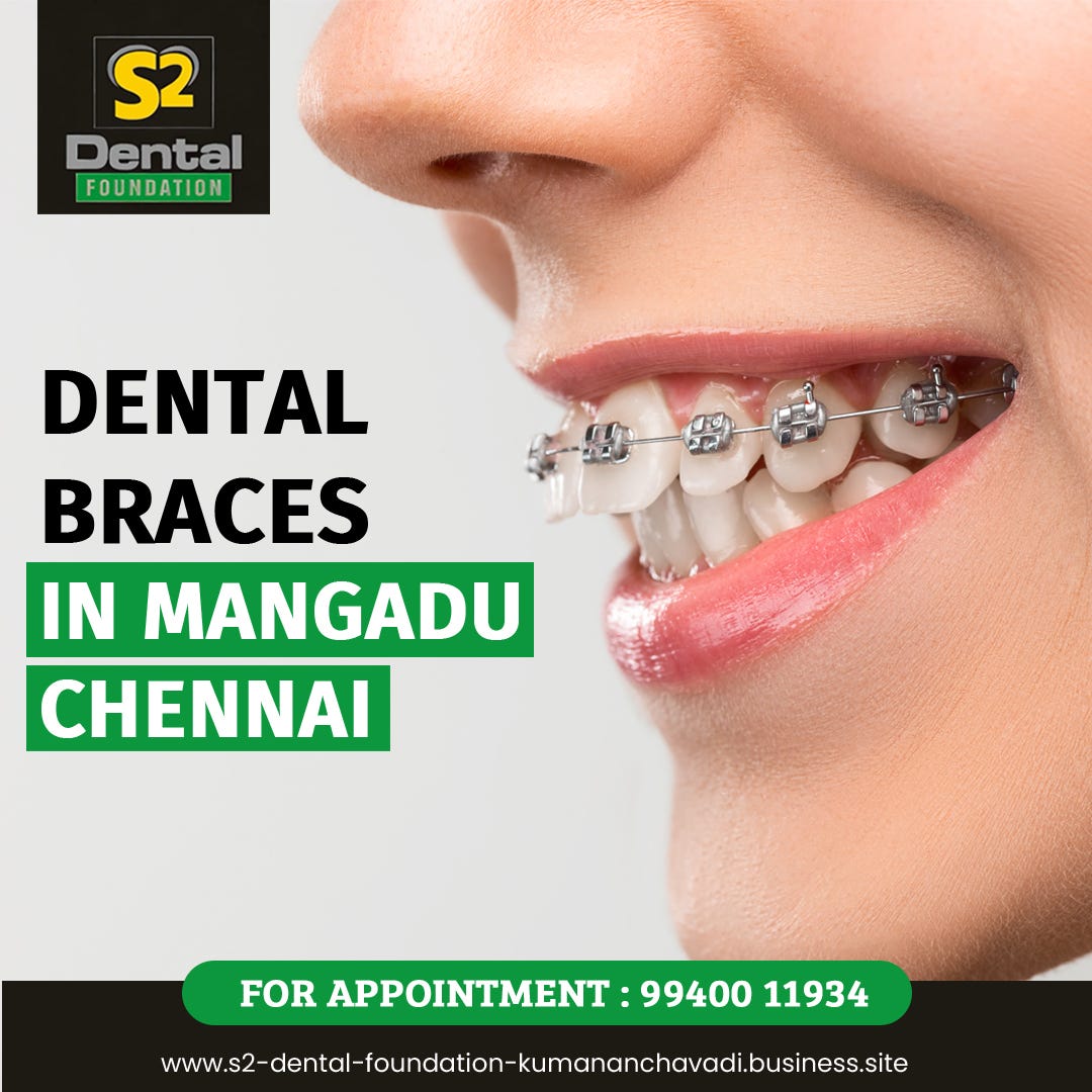 The Evolution of Dental Braces: From Traditional to Advanced Techniques ...