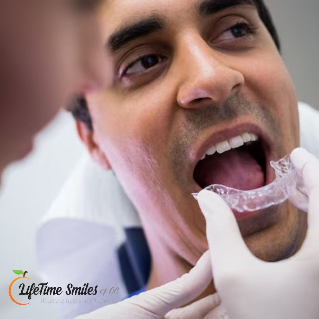 Unveiling the Smile Makeover: A Comprehensive Guide to the Invisalign ...