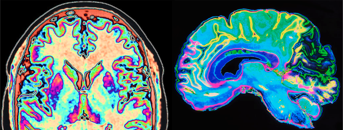Python in Medical Imaging. An ROI Extraction Example | by León Andrés M ...