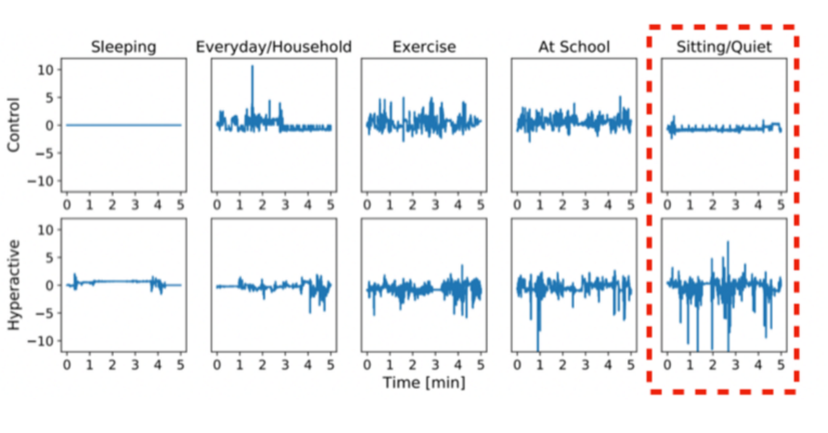 ADHD (Hyperactivity) Detection in Children by Smartwatch | by @hciphds ...